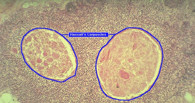 NBDE Review Questions: Quiz 83 - medicalkidunya