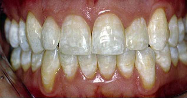 NBDE Review Questions: Quiz 248 - medicalkidunya