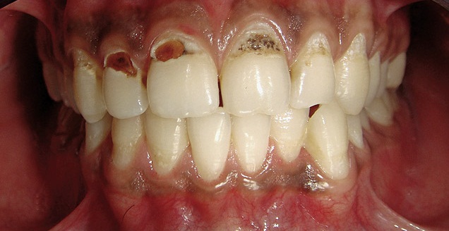 NBDE Review Questions: Quiz 223 - medicalkidunya