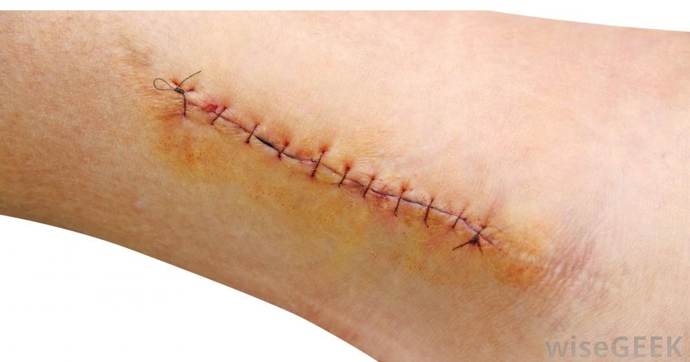 CST Review Questions: Quiz 122 - medicalkidunya