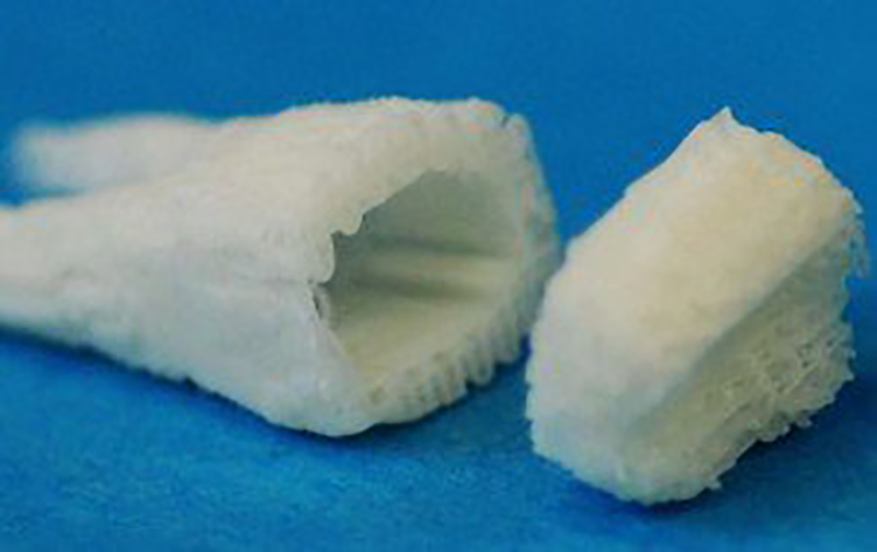 Stem-Cell Dental Implants Grow New Teeth in Your Mouth - medicalkidunya